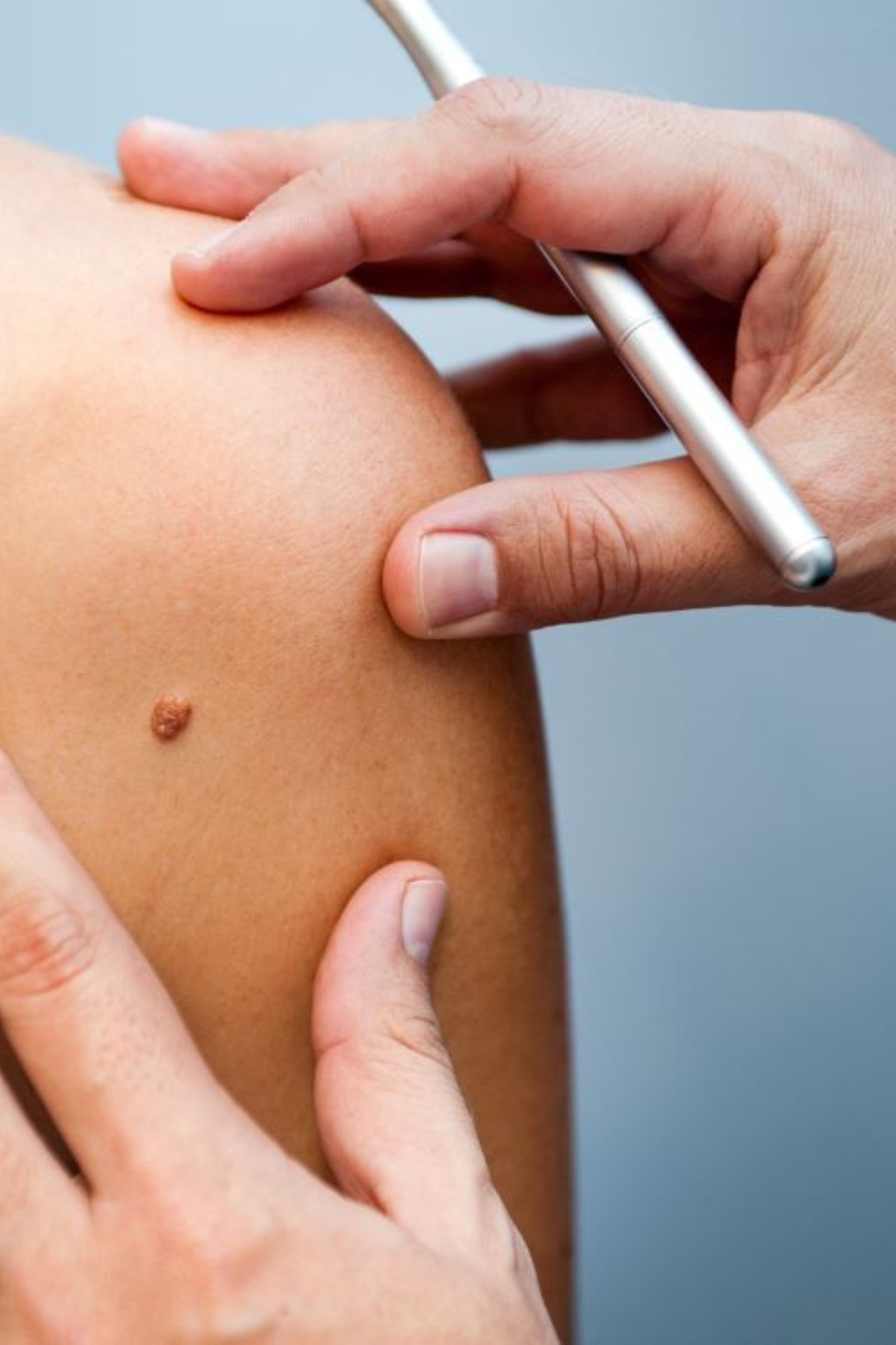 Skin Checks - Skin and Cancer Associates, Florida